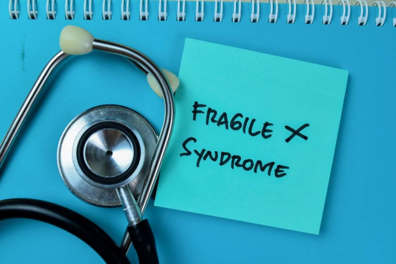 Síndrome do X Frágil: conheça as causas e os sintomas