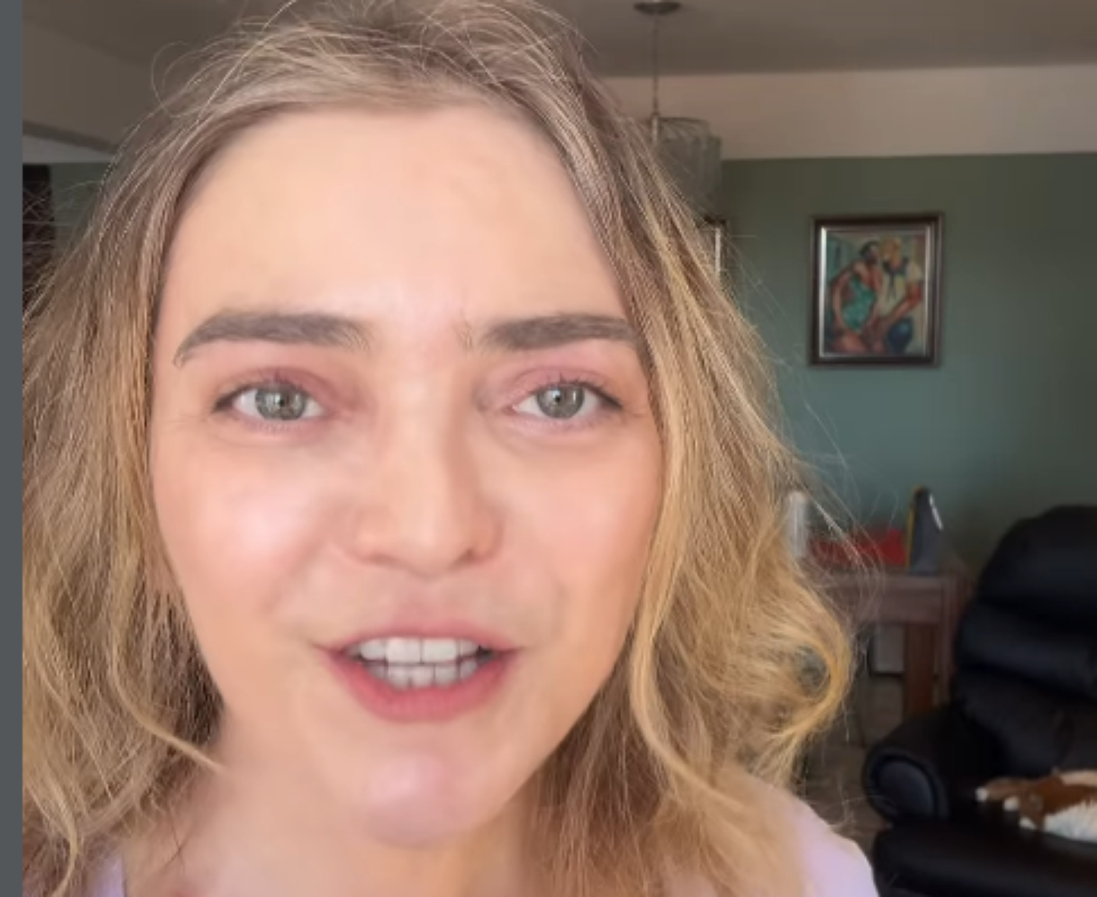 Atriz da Globo morreu com câncer no pâncreas: quais os primeiros sintomas