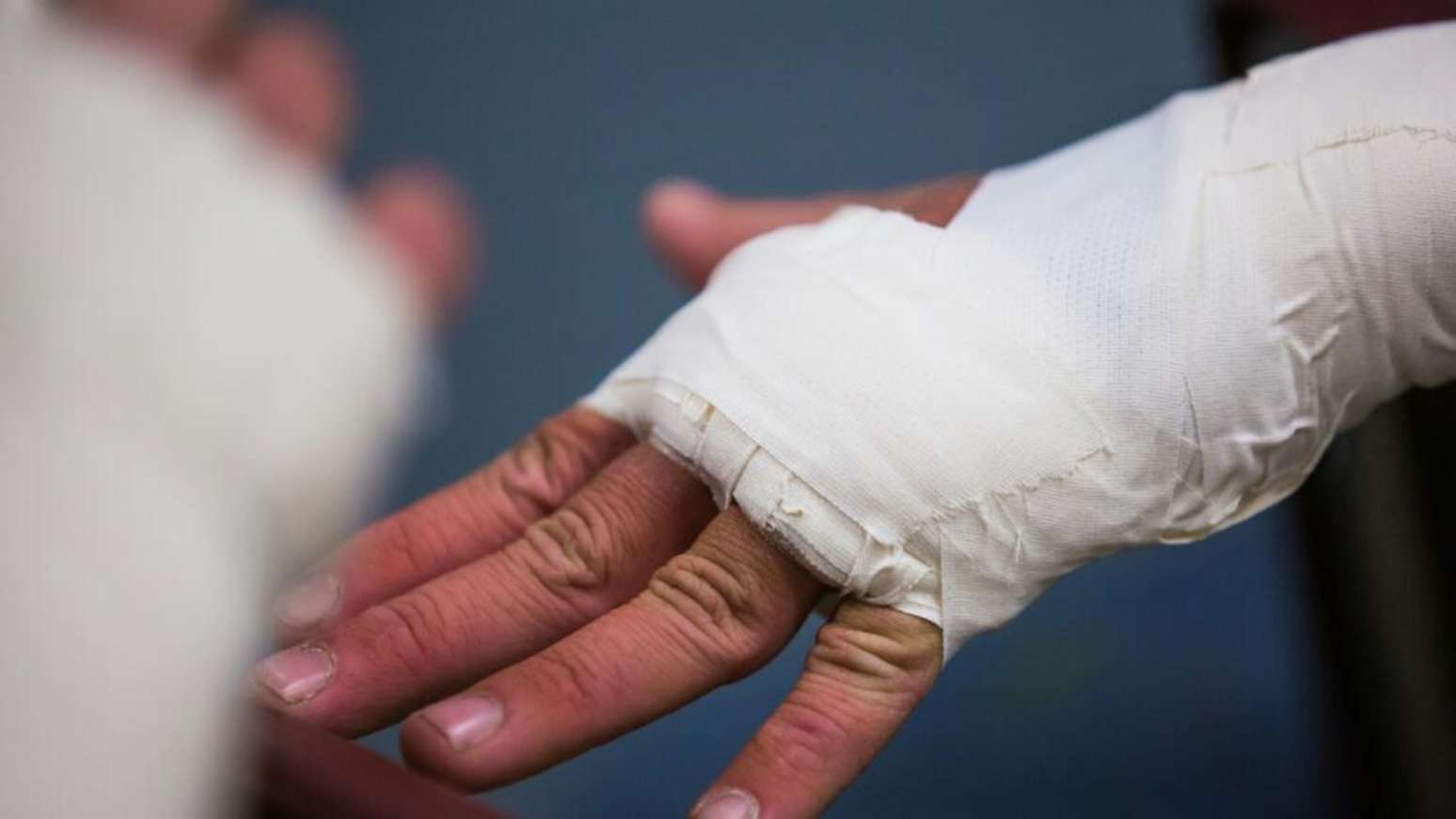 Ferimentos nas mãos não devem ser banalizados; cirurgião explica riscos