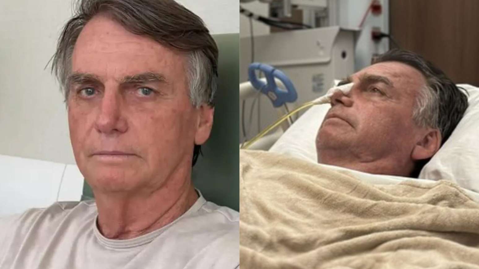 Grave! Estado de saúde de Bolsonaro: Ex-presidente apresenta piora ...
