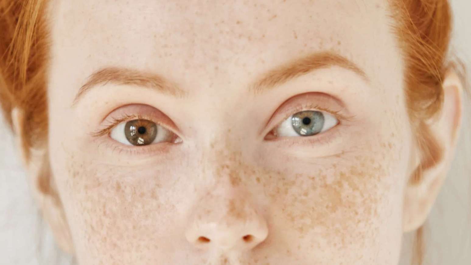 Entenda por que algumas pessoas têm olhos de cores diferentes