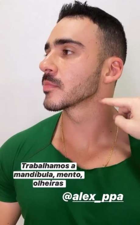 A mudança do cantor Alex Stella após sua harmonização