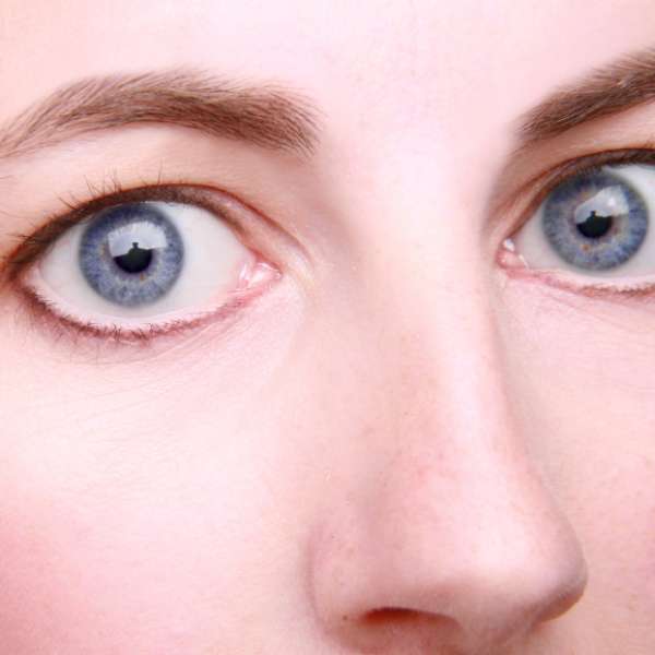Exoftalmia: Saiba quando olhos saltados são motivo de preocupação