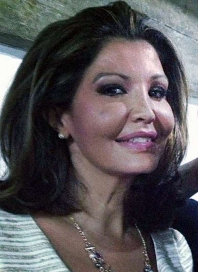 Transexuais brasileiras: quem faria um reality como Caitlyn?