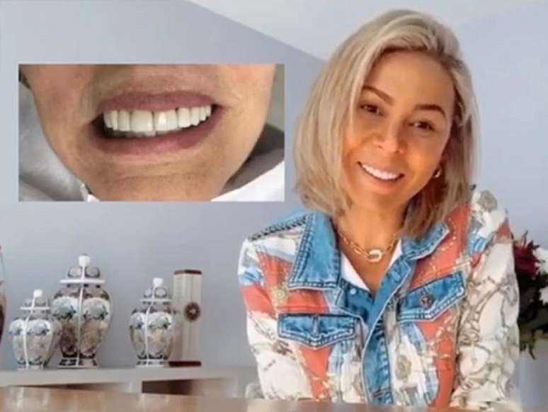 Gabrielle Mocellin: A dentista das lentes de contato dental