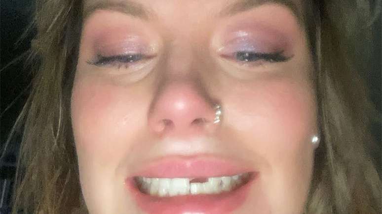 'Por que compartilhei na internet fotos da agressão que sofri'