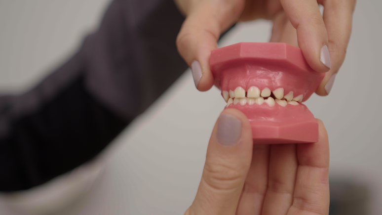 Tipos de mordida: como identificar e tratar a mordida profunda em ...