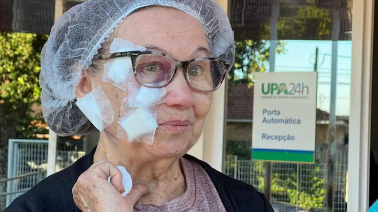 Idosa de 79 anos é atacada por pitbull e leva 50 pontos no rosto no ... Idosa de 79 anos é atacada por pitbull e leva 50 pontos no rosto no ...
