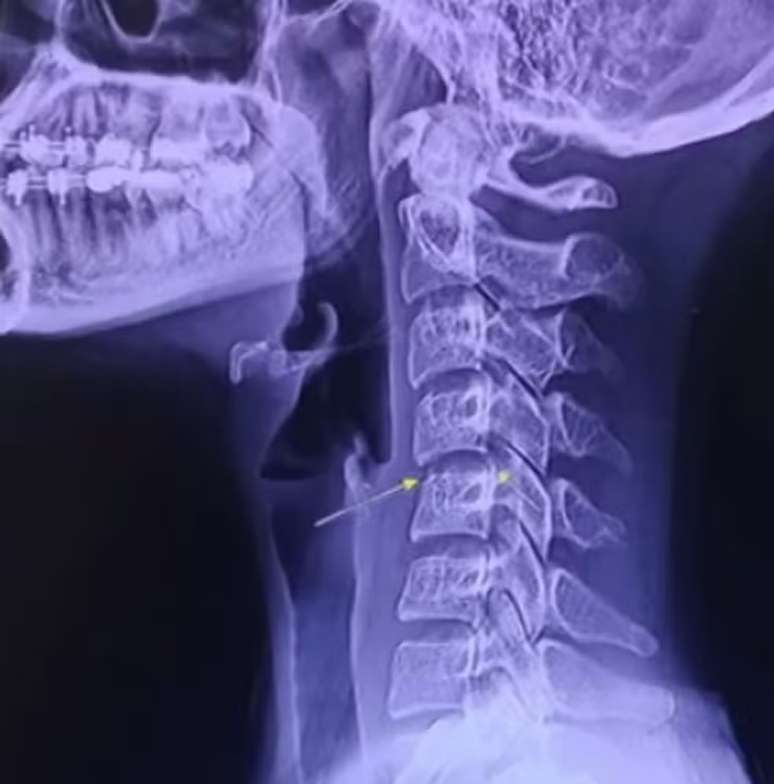 Saiba tudo sobre Ping Chayada, cantora de 20 anos que teve morte trágica