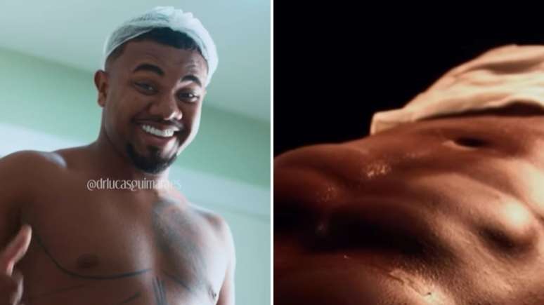 Davi Brito mostra resultado da lipo HD: 'Ficou simplesmente surpreendente'