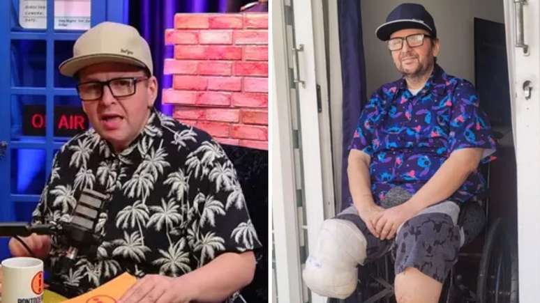 Humorista David Castilho, ex-'A Praça É Nossa', revela amputação de ...