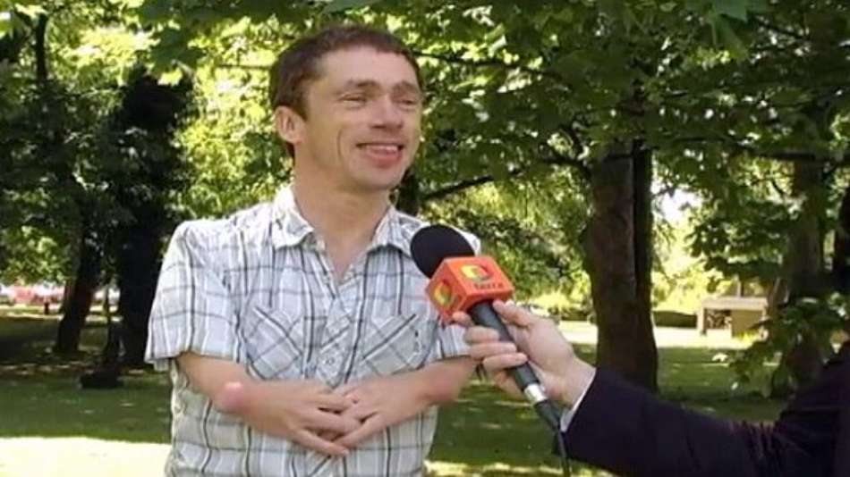 Portador de focomelia faz história na TV da Irlanda