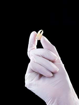 Dente quebrado e língua cortada: o que fazer se o filho cair